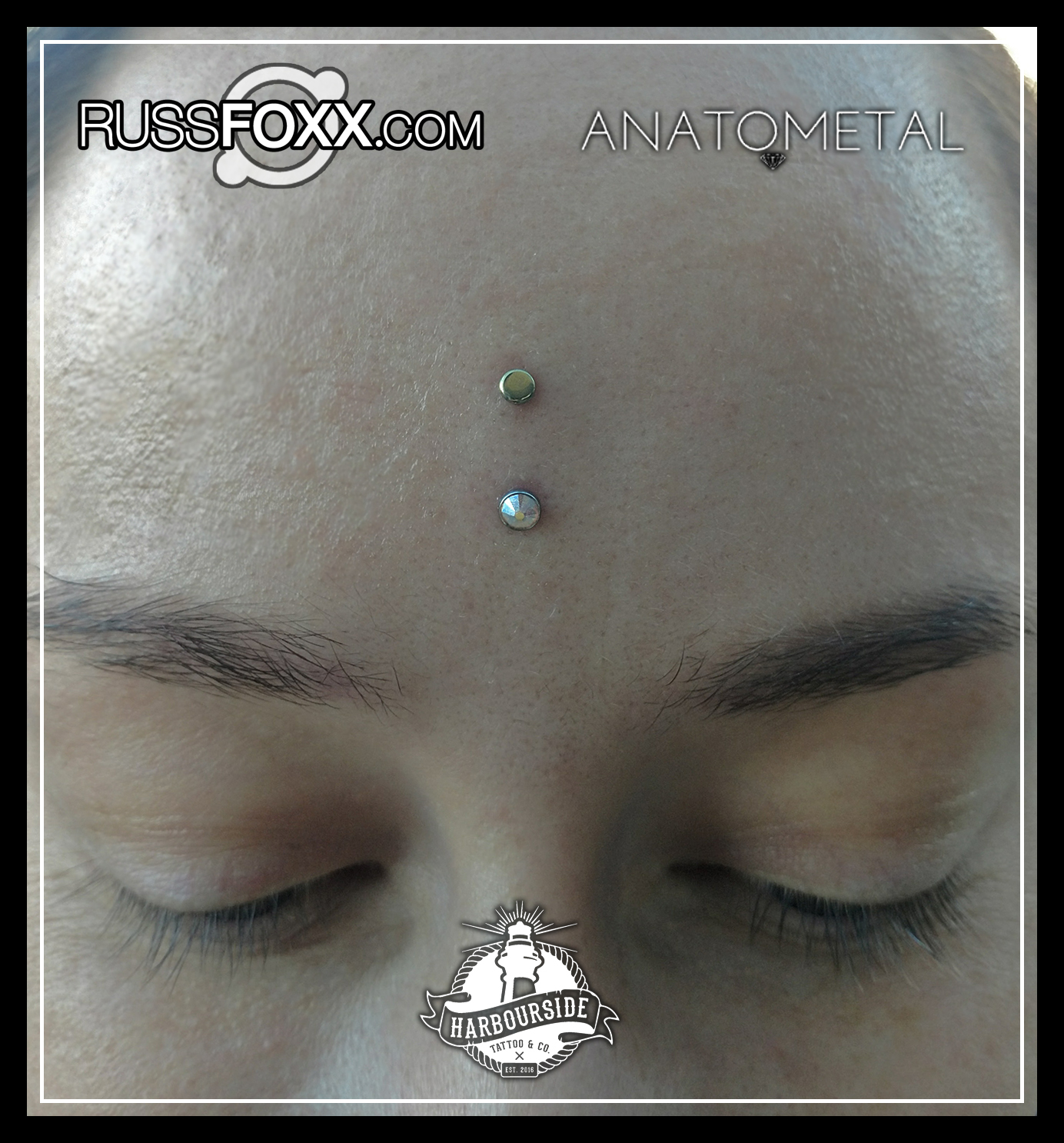 Microdermal Anchors – Russ Foxx